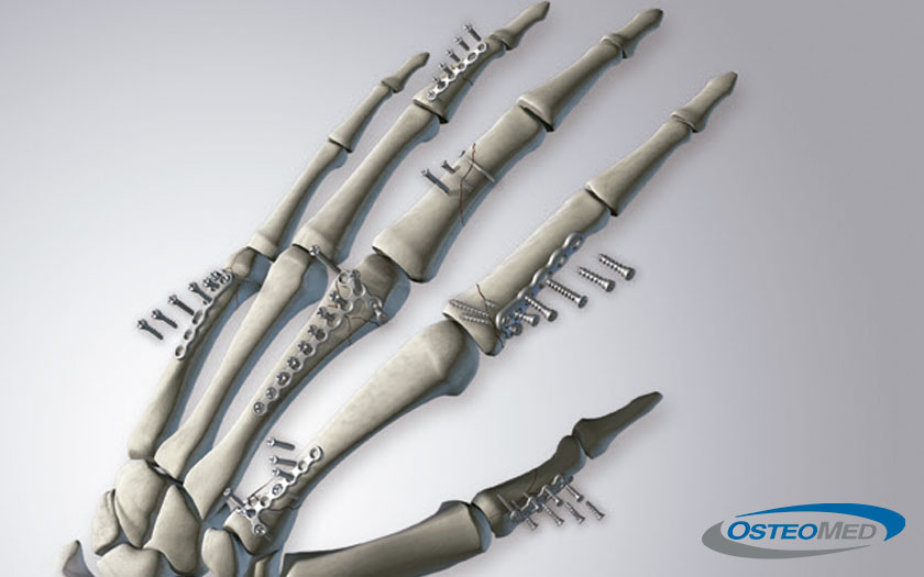 Logistic Medical - Columna, Traumatología y Ortopedia